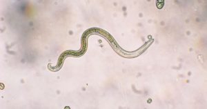 21 Parasite Symptoms and How to Fight Parasitic Infection with Herbs ...