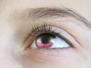 15 Ways That Heart Disease Affects Your Eyes - Organically Human