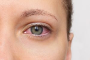 15 Ways That Heart Disease Affects Your Eyes - Organically Human