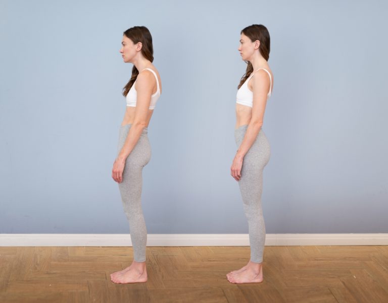 How to Fix the 4 Most Common Posture Problems - Organically Human ...